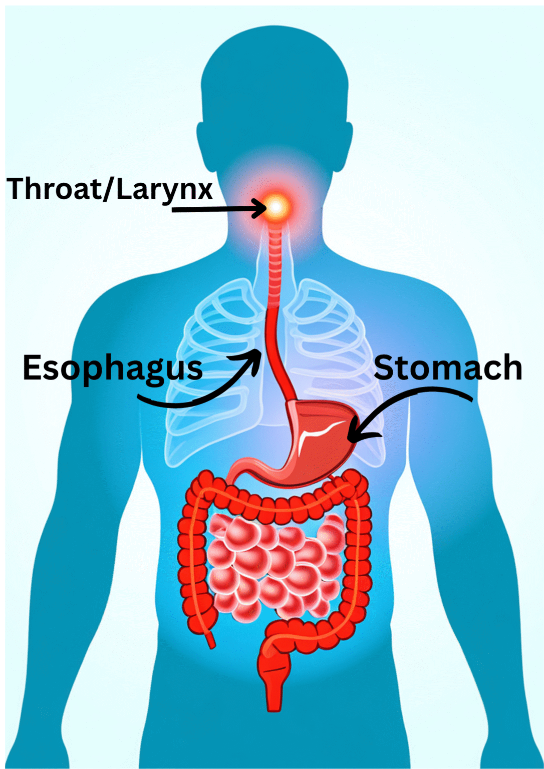 Silent Reflux Treatment: Why Most Doctors Misdiagnose LPR and How to ...